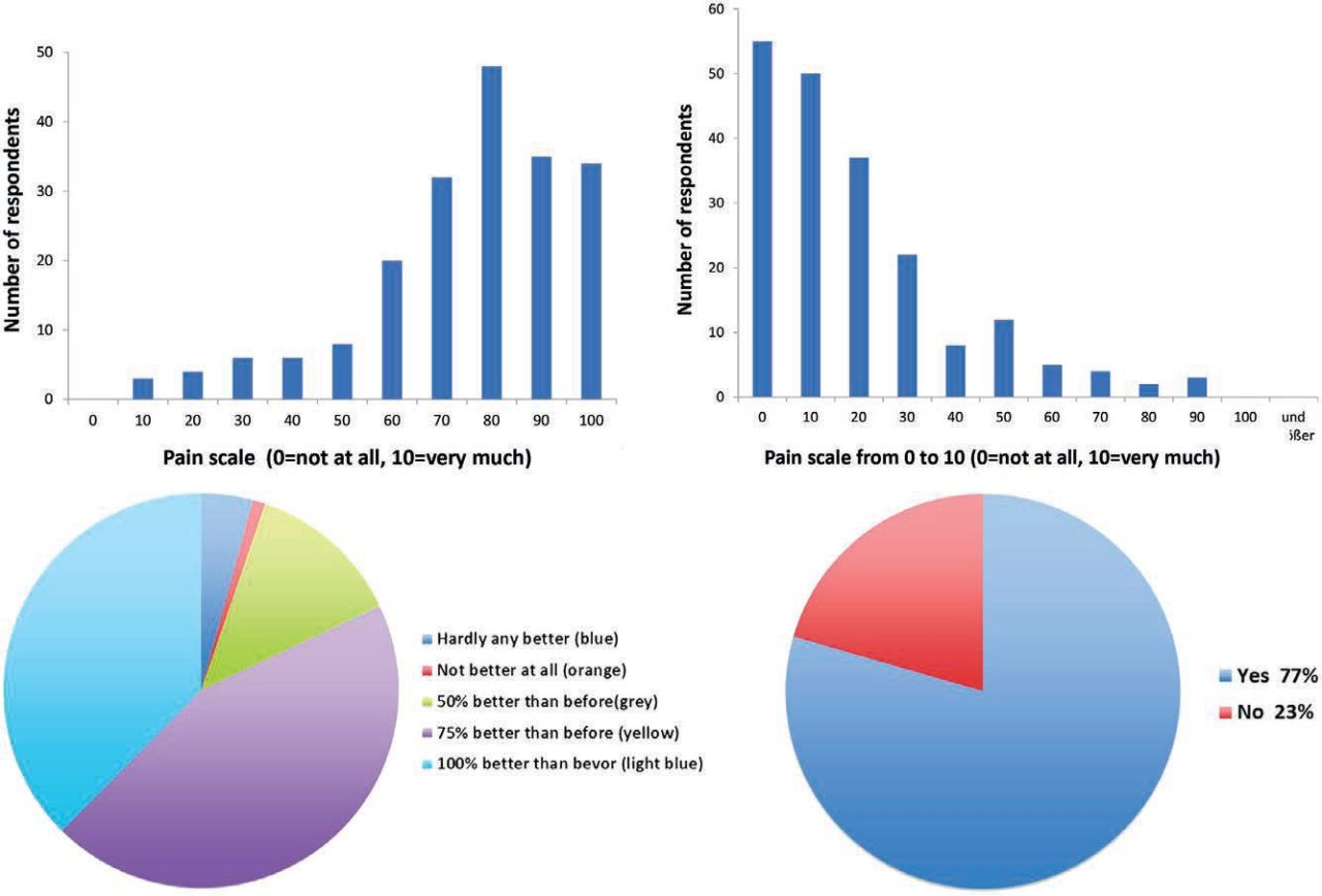 New Insights on Lipedema: The Enigmatic Disease of the Peripheral Fat ...